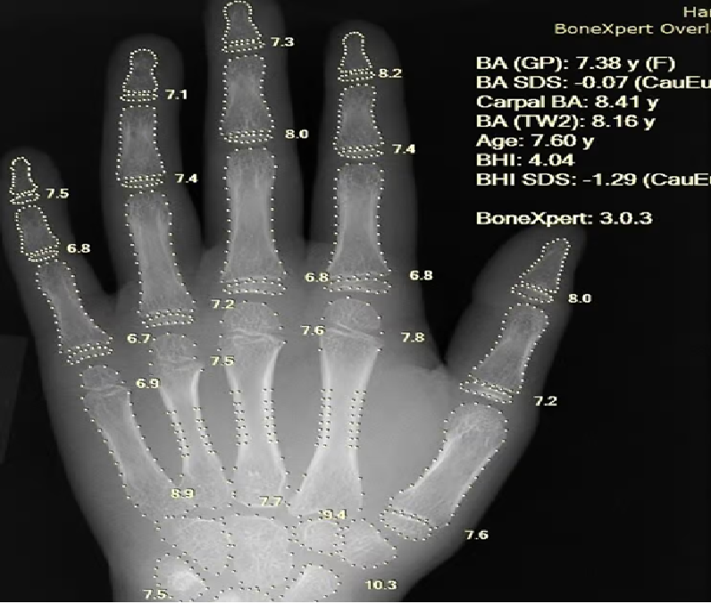 Uzbekistan introduces its first national AI System: BONU AGI | London Post